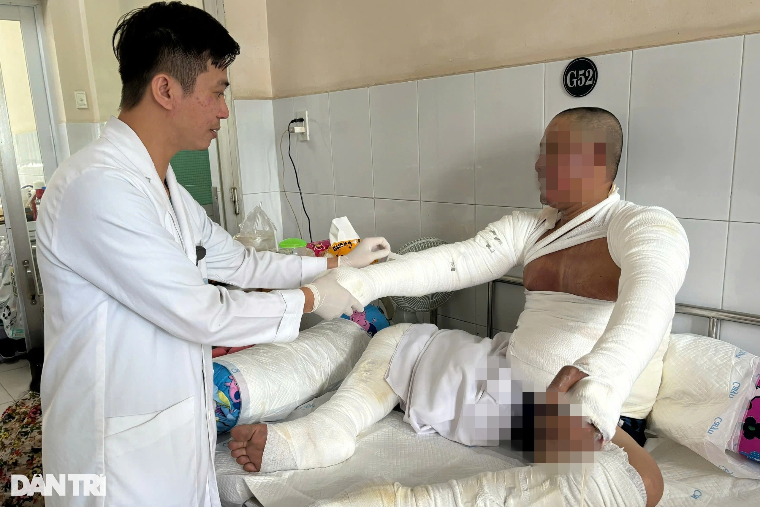Nạn nhân bỏng khắp cơ thể vì tai nạn máy nén khí gas: Bi kịch sau tiếng ...