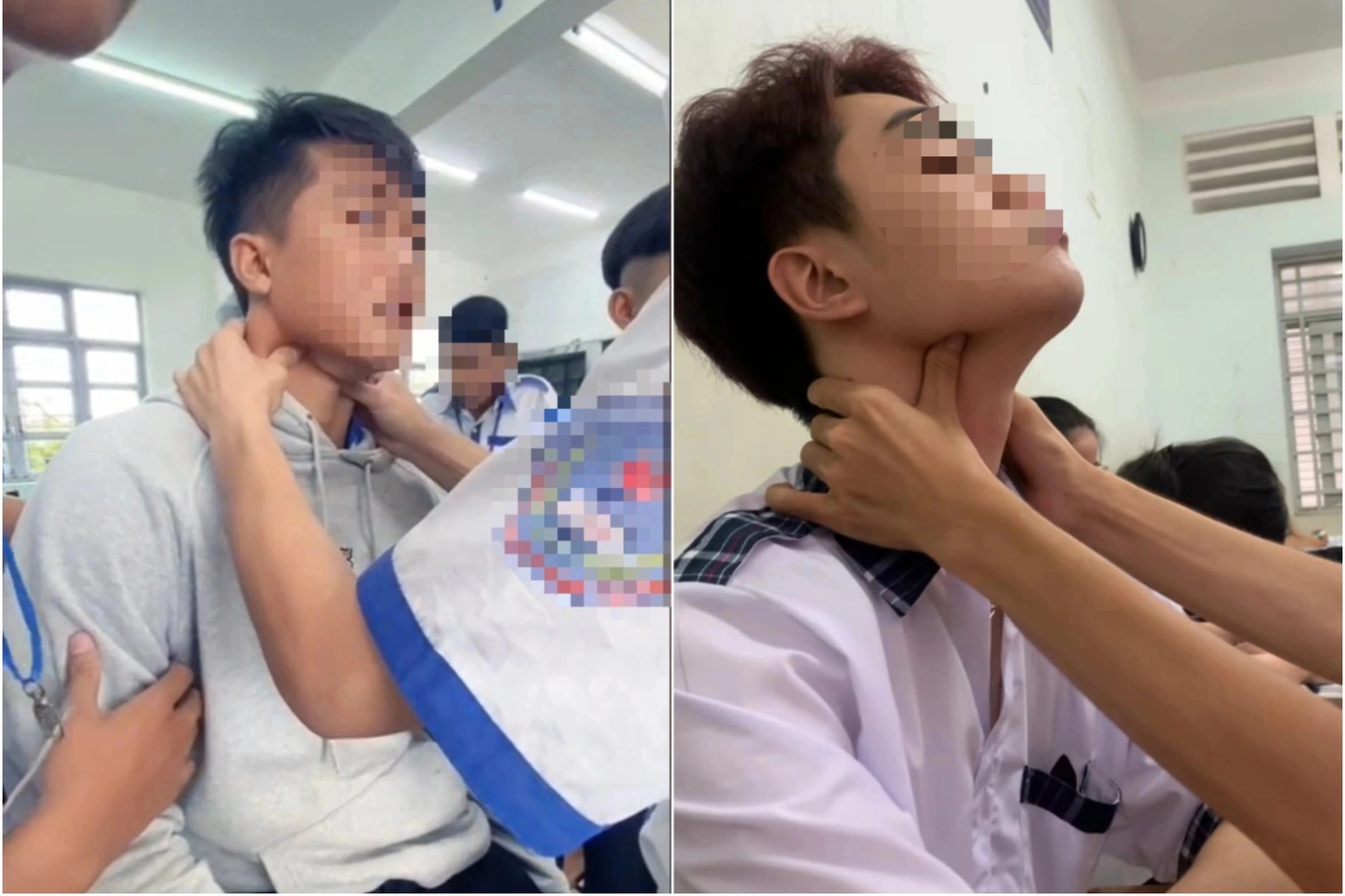 Học sinh đua nhau "bắt pen", bác sĩ giật mình vì quá nguy hiểm | Báo Dân trí