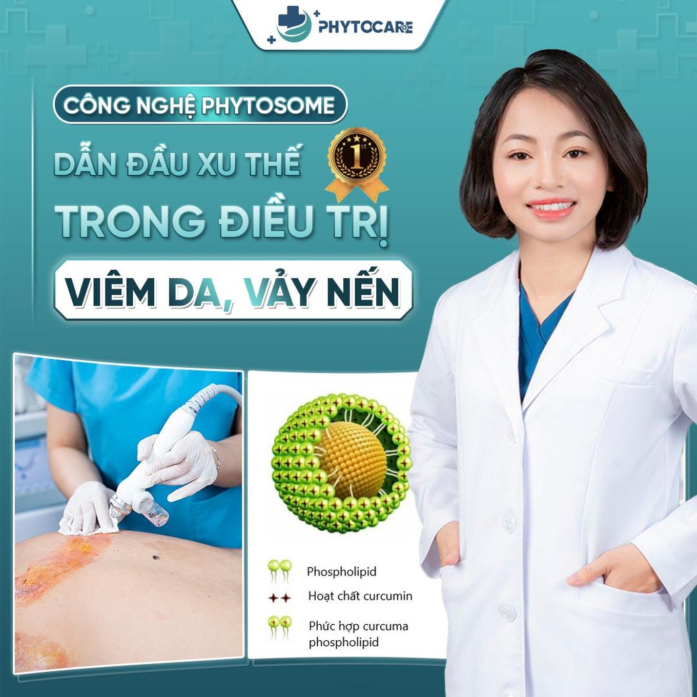 Giải pháp cho người bị viêm da cơ địa, vảy nến | Báo Dân trí